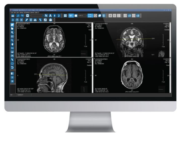 Gateway™ Viewer Mini PACS - PT. Satya Abadi Visimed